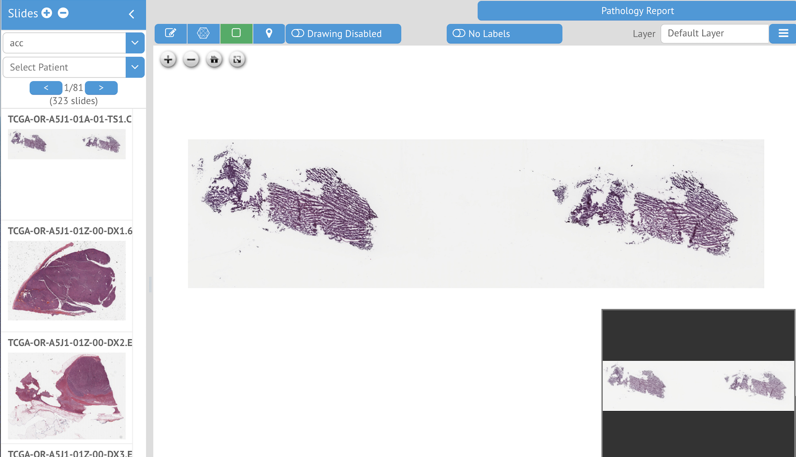 ATHENA TECH – Where Artificial Intelligence and Medicine meet